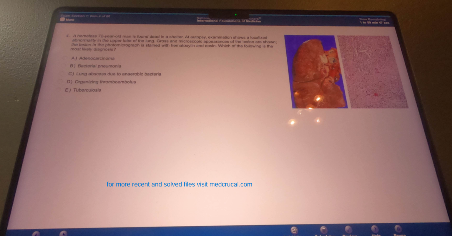 IFOM 2024 Exam Recalls: Latest Questions, Study Materials, and ...